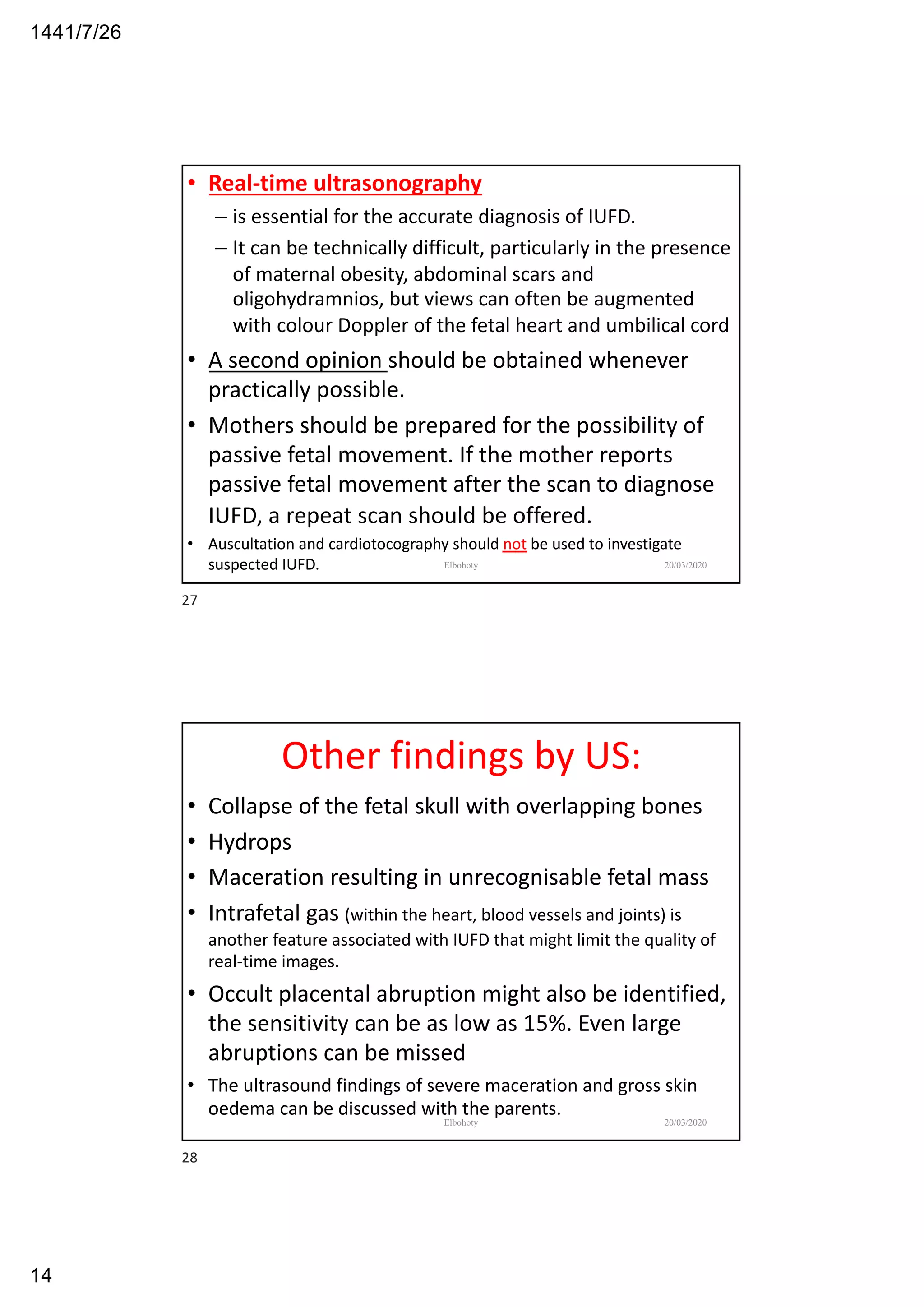 Intrauterine fetal demise (iufd) | PDF