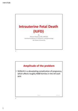 Intrauterine fetal demise (iufd) | PDF