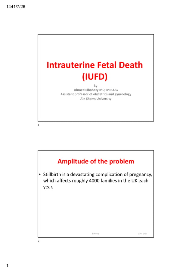 Intrauterine fetal demise (iufd) | PDF | Pregnancy | Reproductive Health