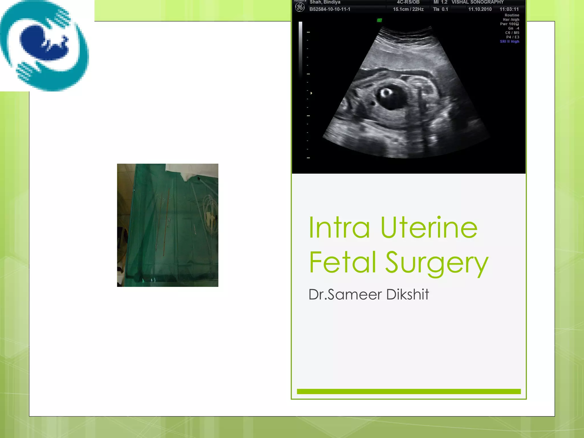Intra uterine fetal surgery | PPT