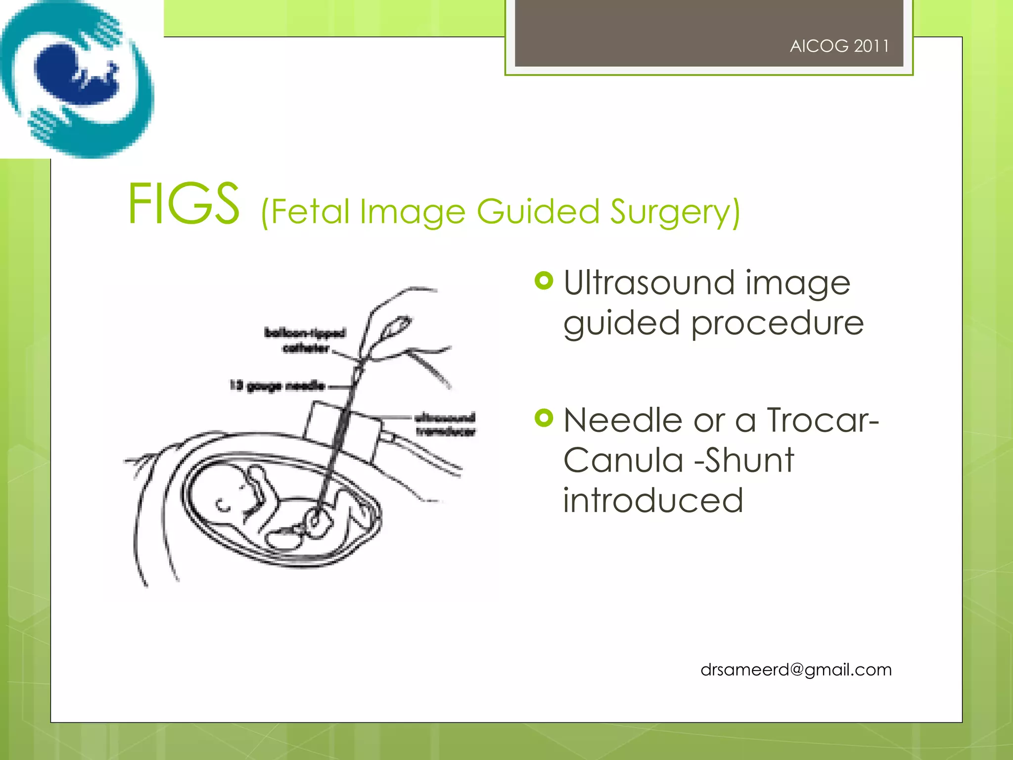 Intra uterine fetal surgery | PPT