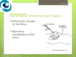 Intra uterine fetal surgery | PPT