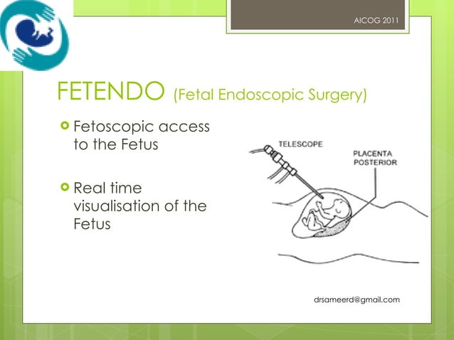 Intra uterine fetal surgery | PPT