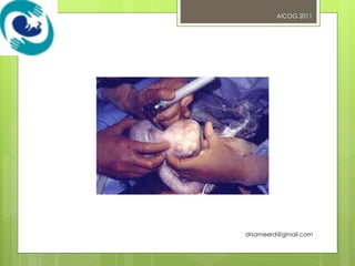 Intra uterine fetal surgery | PPT