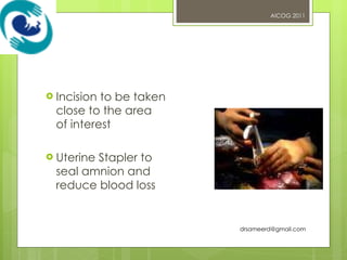 Intra uterine fetal surgery | PPT