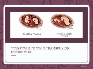 Intrauterine fetal therapies and nursing management of high risk ...