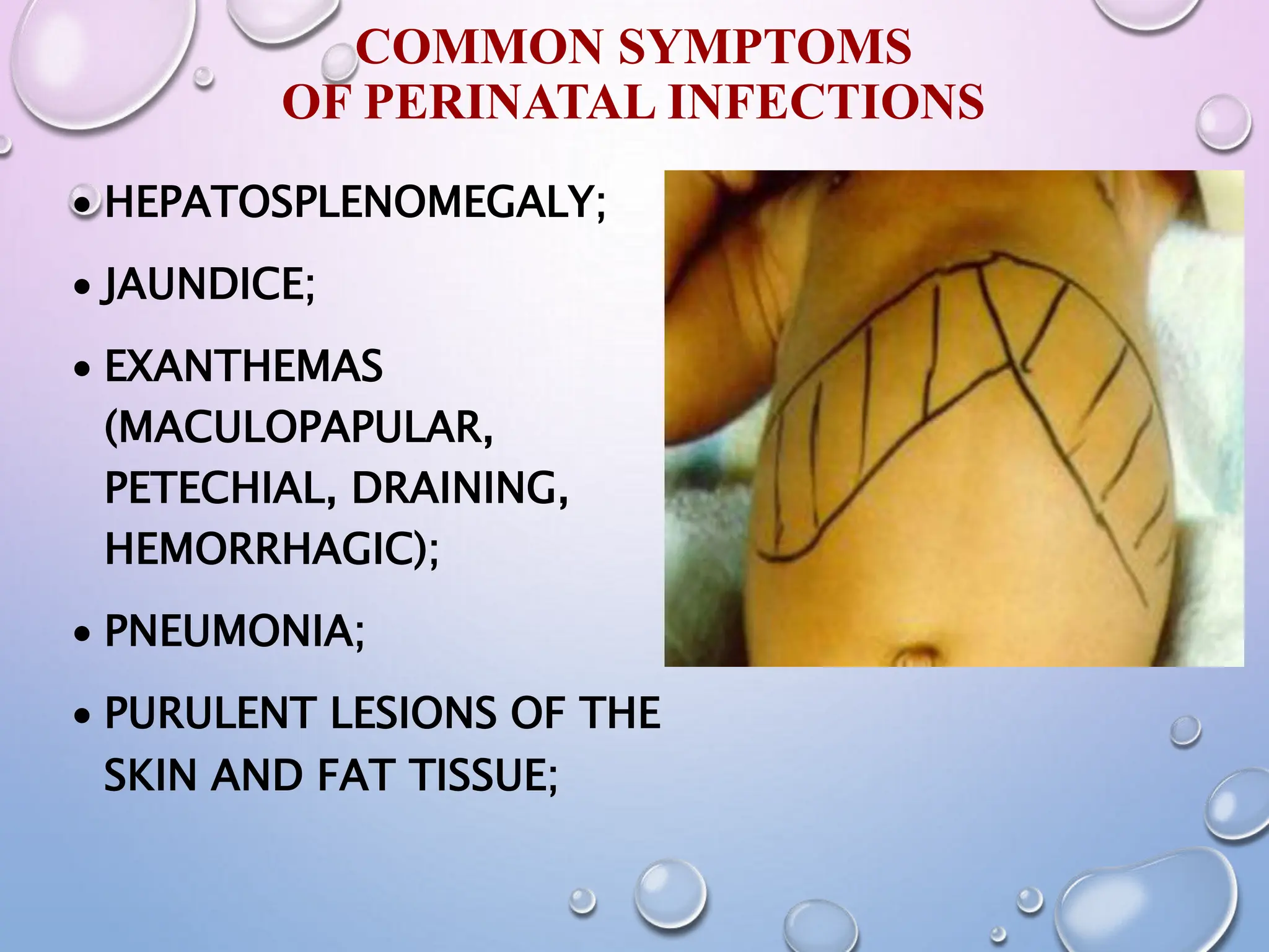 Intrauterine infection in a pregnant women.ppt