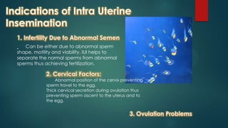 Intra uterine insemination iui | PPTX | Infertility | Reproductive Health