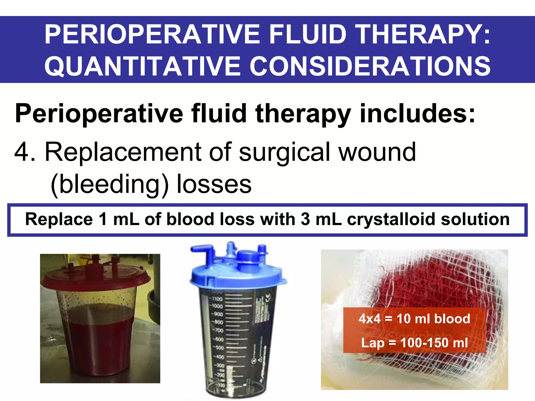 Intravascular_Fluid_Therapy_anesthesia__b7ca9904.ppt | Free Download