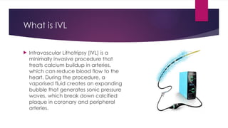 INTRAVASCULAR LITHOTRIPSY (SHOCKWAVE).pptx