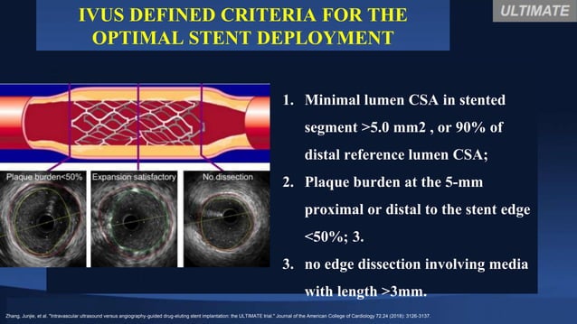 Intravascular Ultrasound Versus Angiography-Guided Drug-Eluting Stent ...