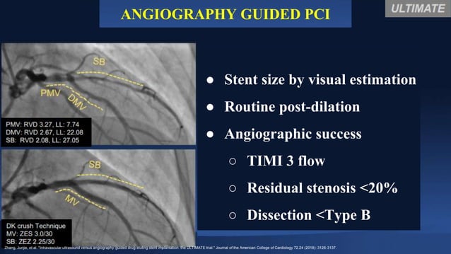 Intravascular Ultrasound Versus Angiography-Guided Drug-Eluting Stent ...
