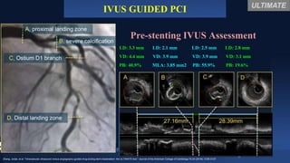 Intravascular Ultrasound Versus Angiography-Guided Drug-Eluting Stent ...