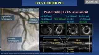 Intravascular Ultrasound Versus Angiography-Guided Drug-Eluting Stent ...