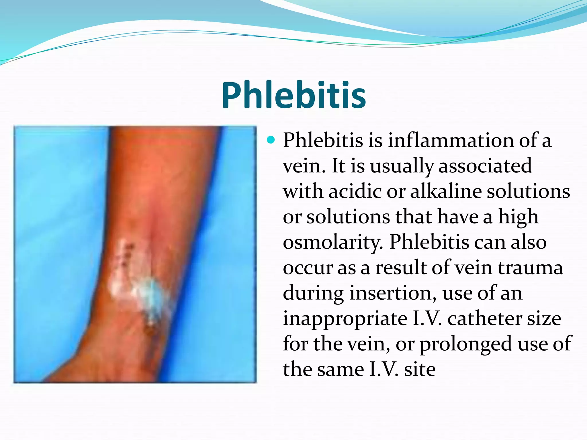 INTRAVENOUS-FLUID-INSERTION-2.ppt