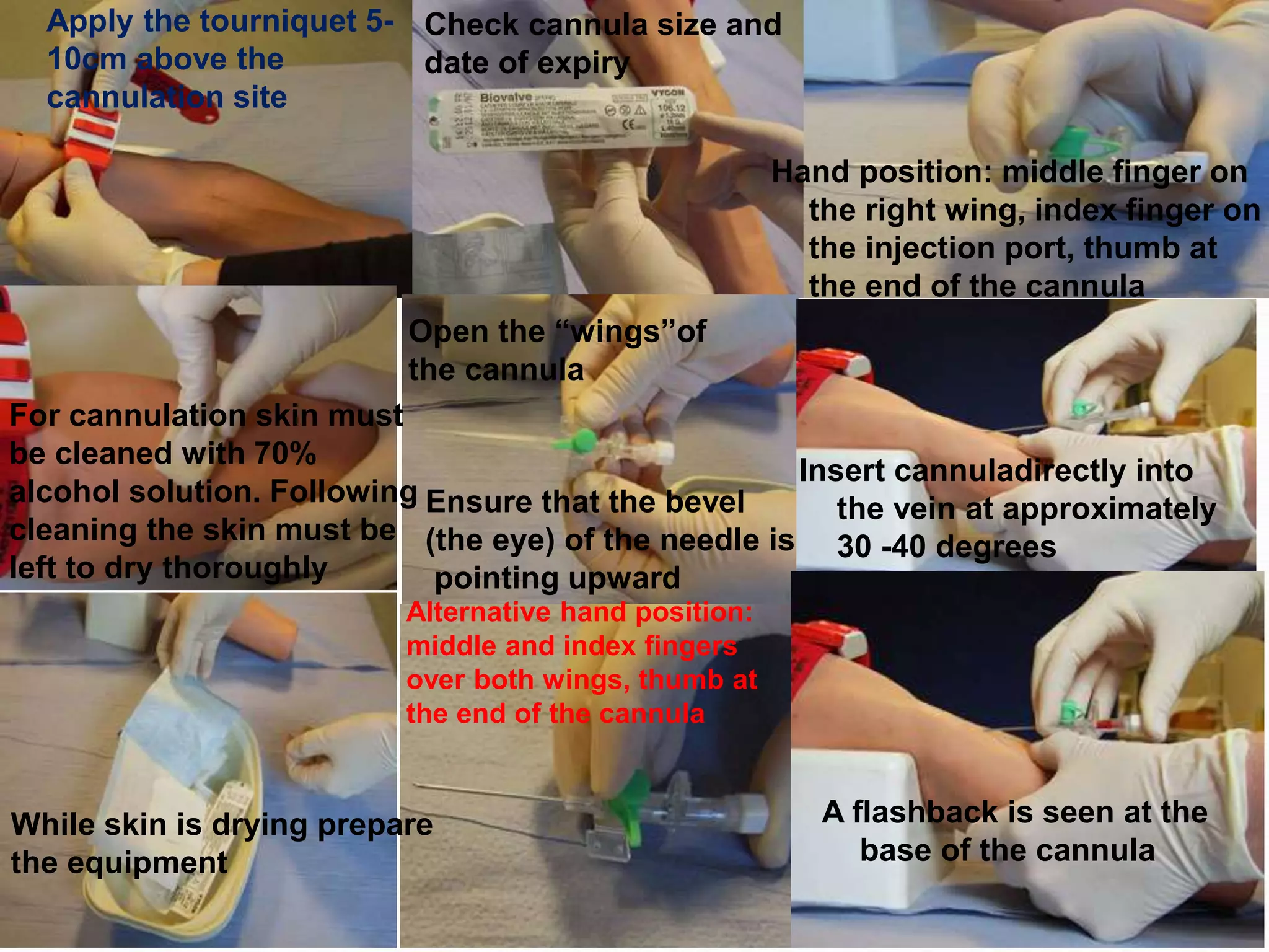 INTRAVENOUS-FLUID-INSERTION-2.ppt