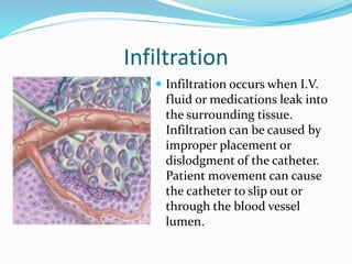 INTRAVENOUS-FLUID-INSERTION-2.ppt
