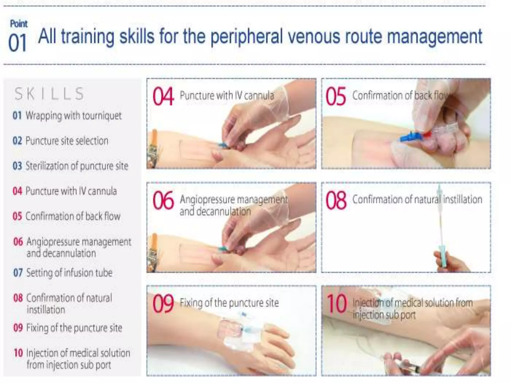 Intravenous cannula | PDF | Medical Health