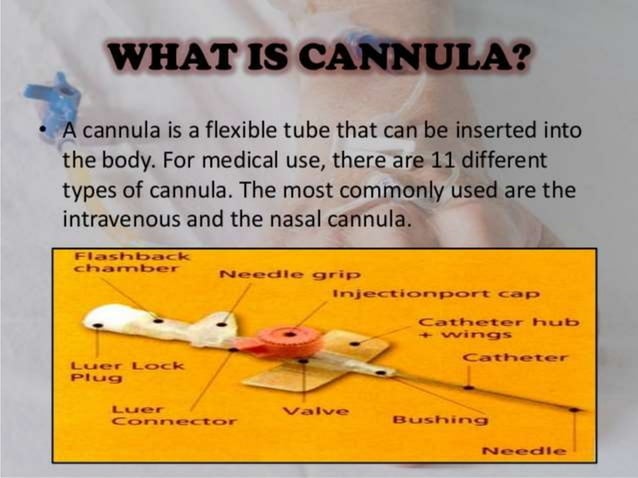Intravenous cannula | PDF | Medical Health