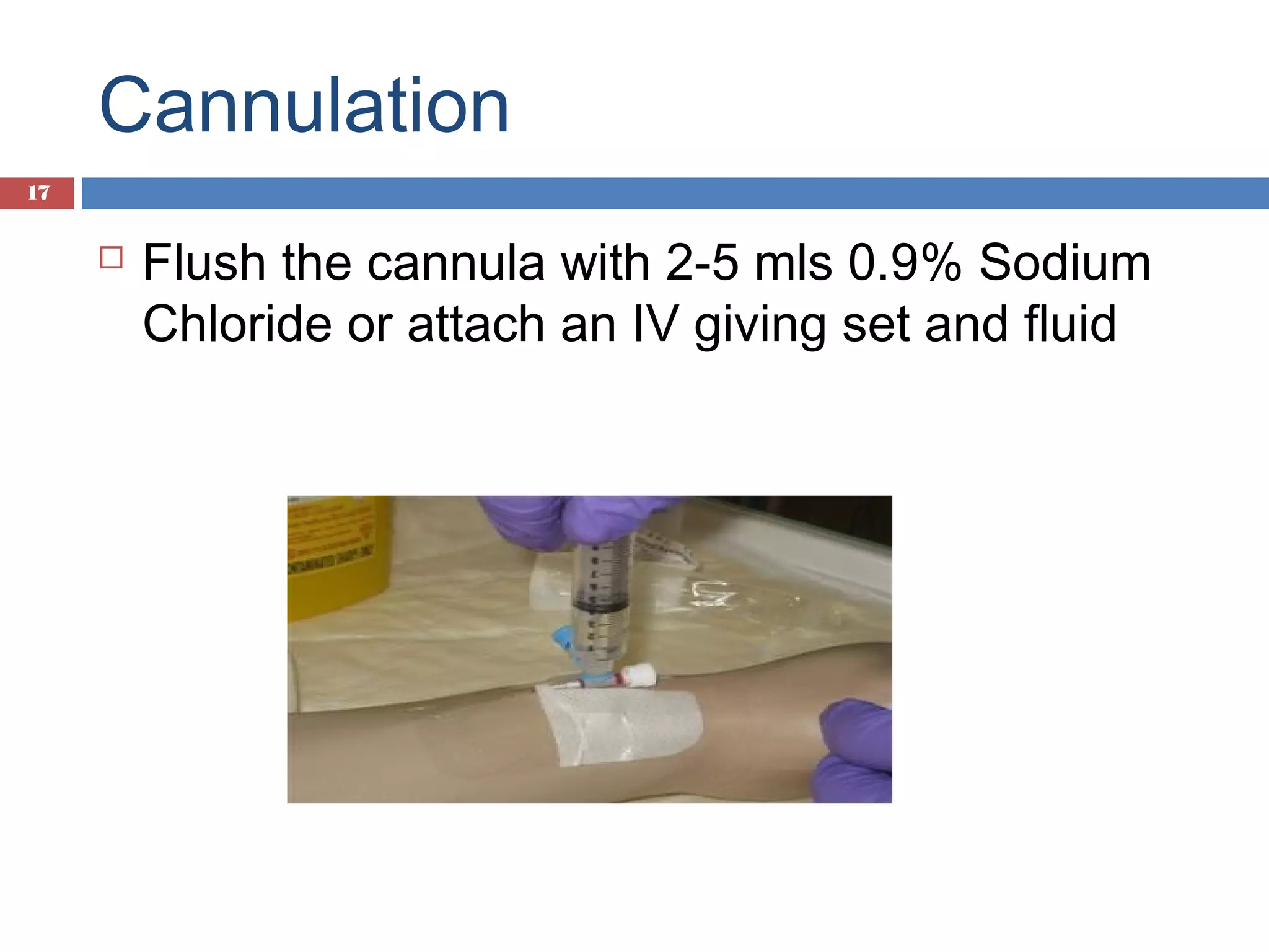 Intravenous cannulation | PPT