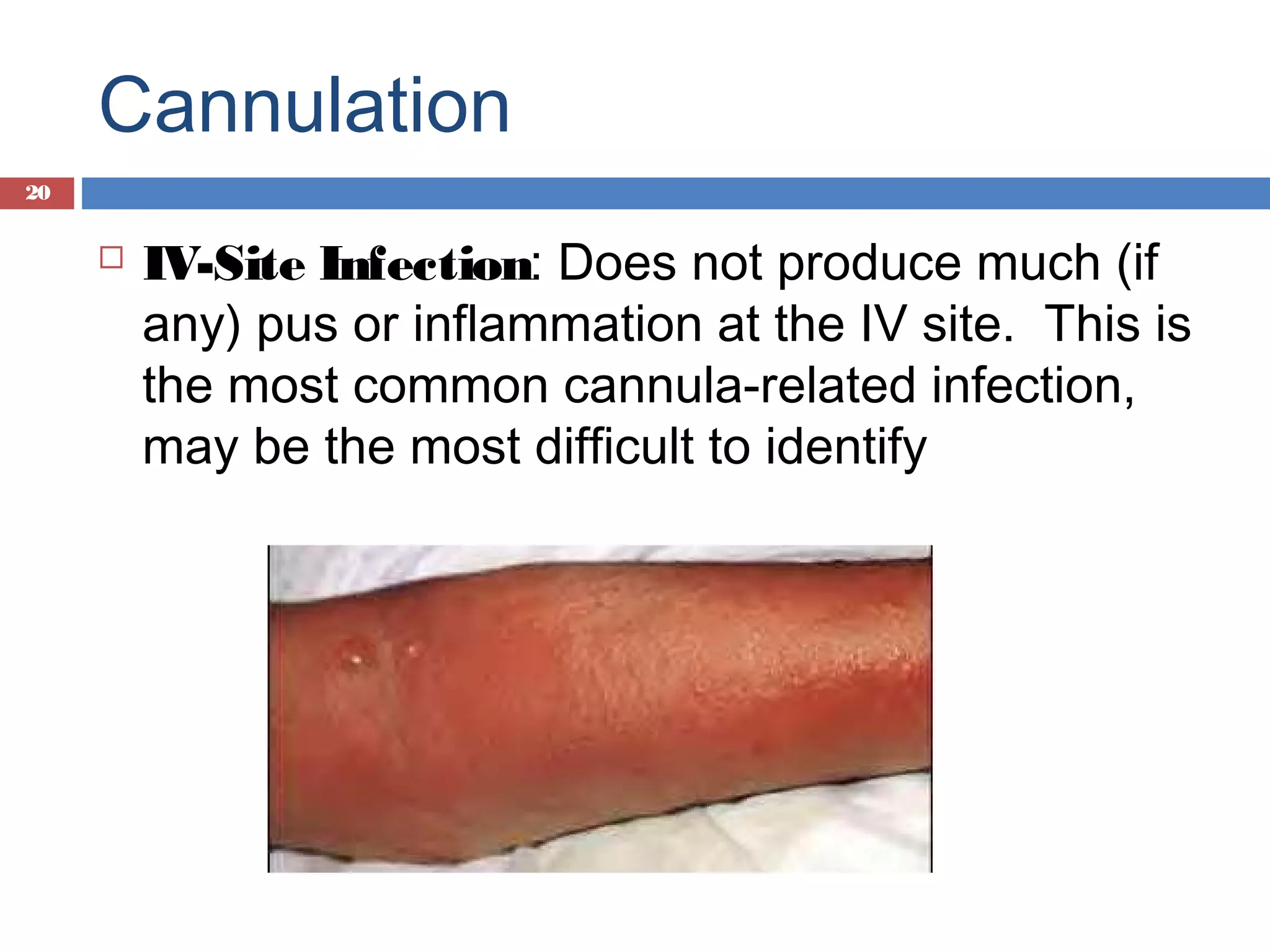 Intravenous cannulation | PPT
