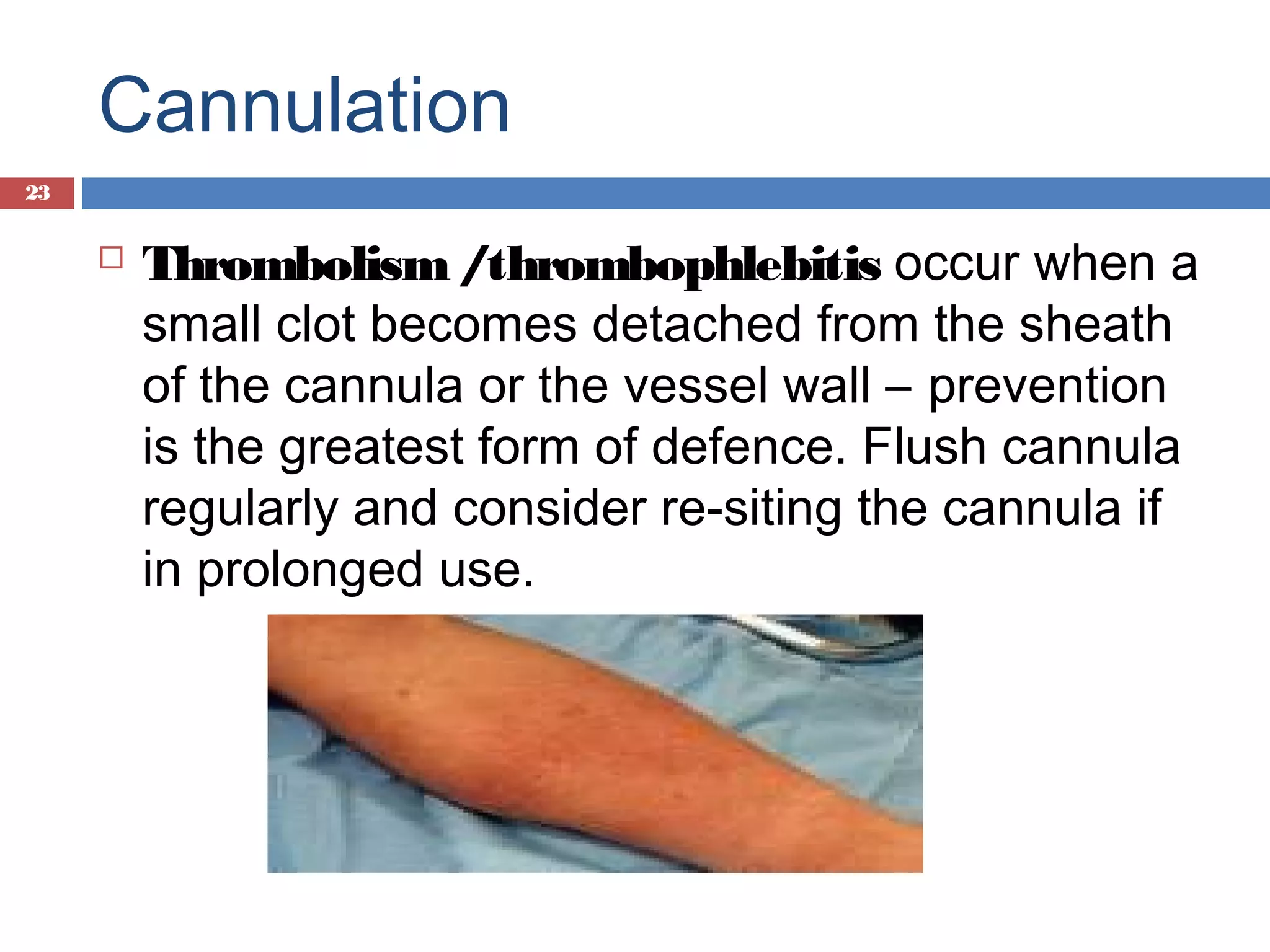 Intravenous cannulation | PPT