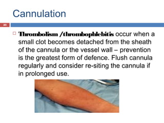 Intravenous cannulation | PPT