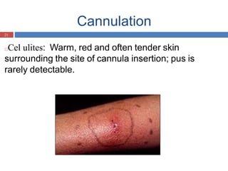 INTRAVENOUS CANNULATION INTRAVENOUS CANNULATION | PPT | First Aid ...