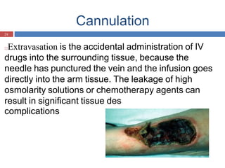 INTRAVENOUS CANNULATION INTRAVENOUS CANNULATION | PPT