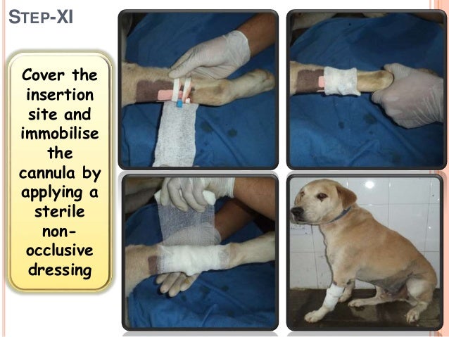 Intravenous catheter