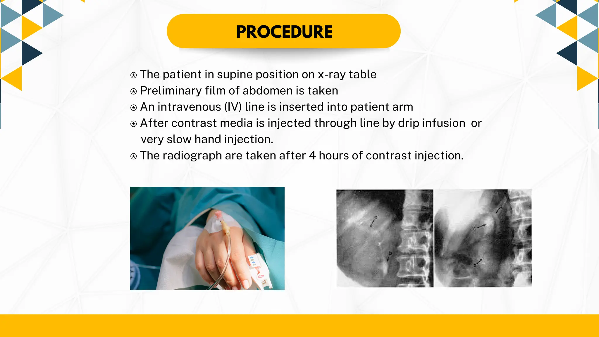 Intravenous Cholangiography procedure done in radiology department | PDF