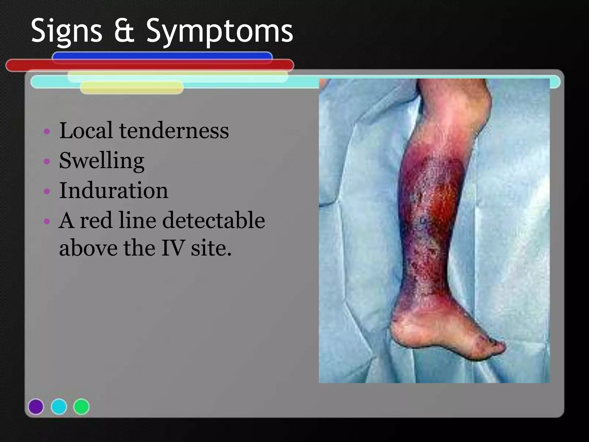 Intravenous Therapy Complications | PPTX