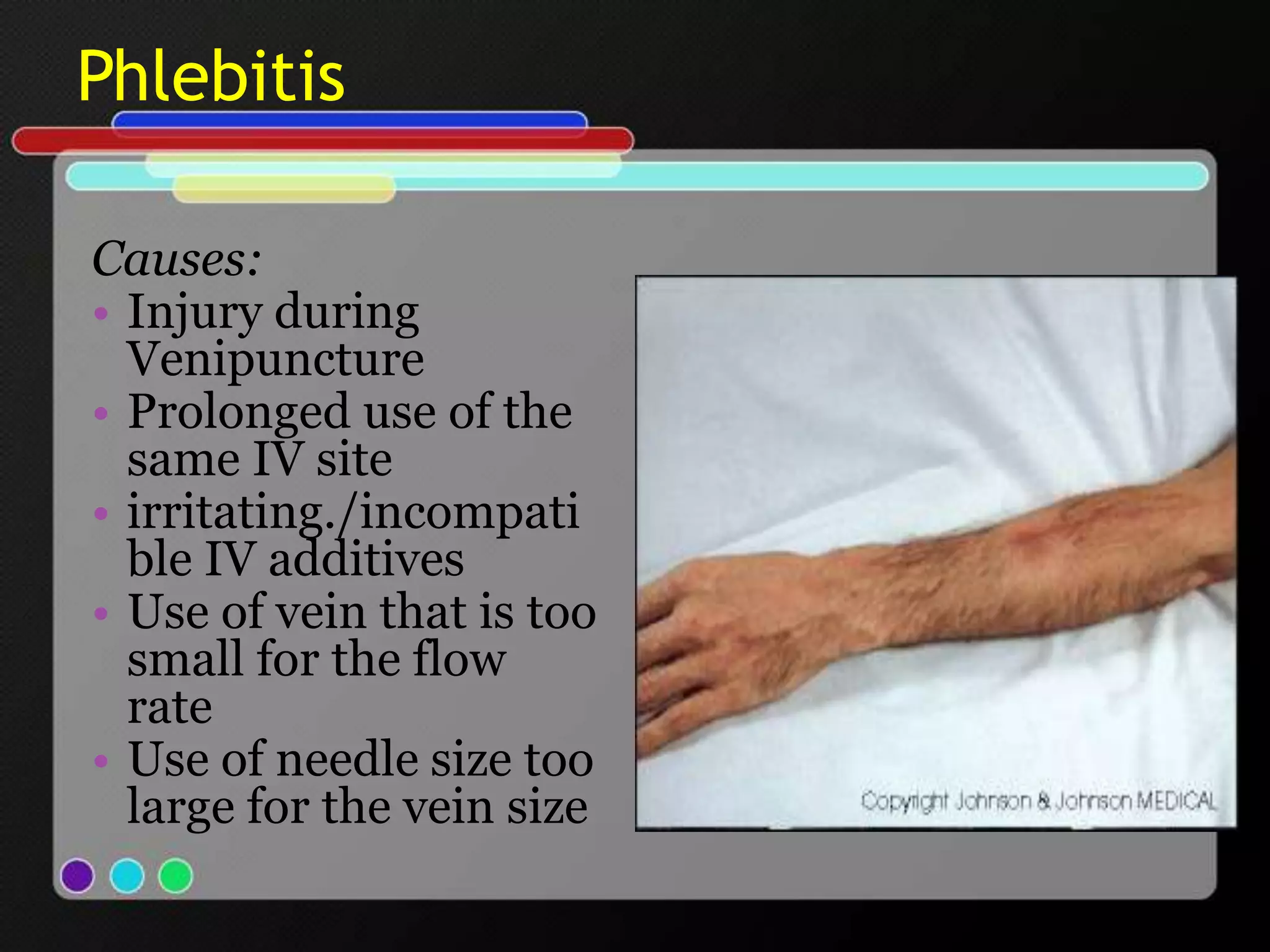 Intravenous Therapy Complications | PPTX