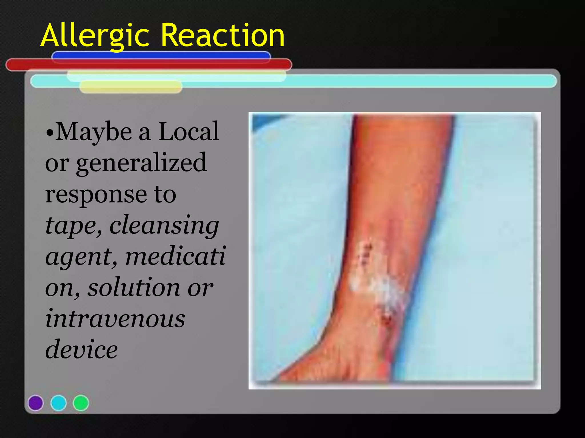Intravenous Therapy Complications | PPTX