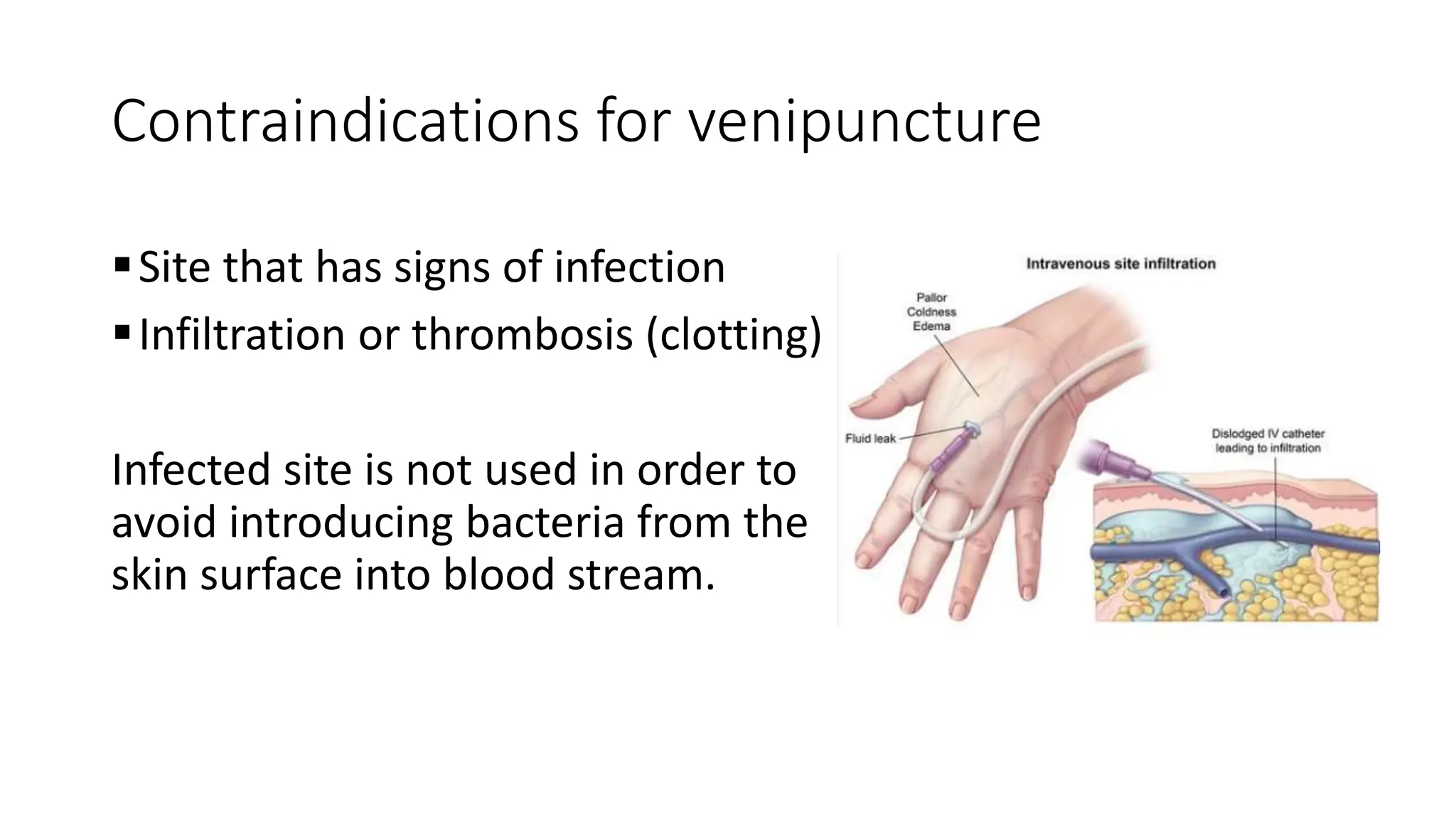 INTRAVENOUS FLUID THERAPY jsvsb with babban mbsvkst | PPTX