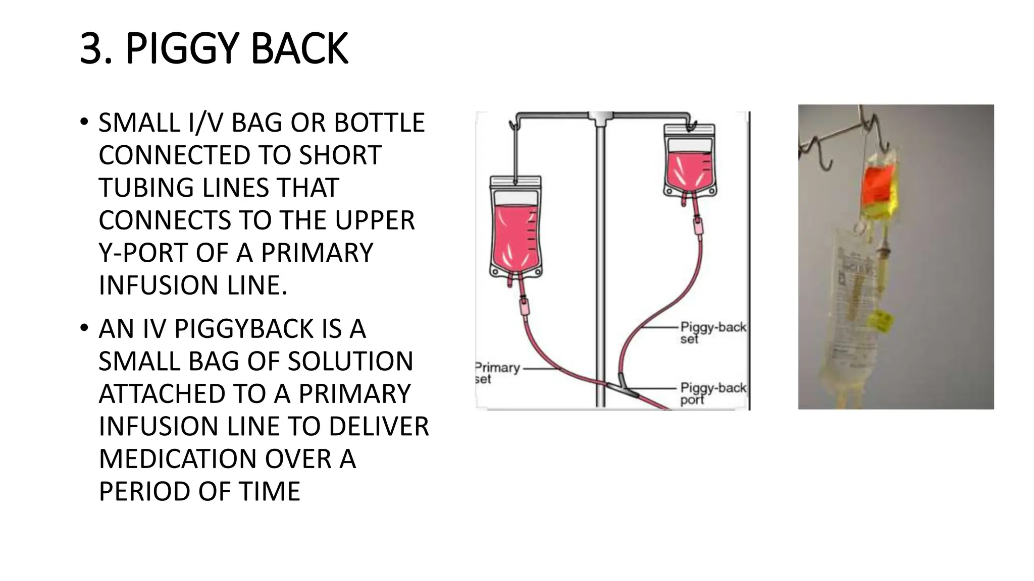 INTRAVENOUS FLUID THERAPY jsvsb with babban mbsvkst | PPTX