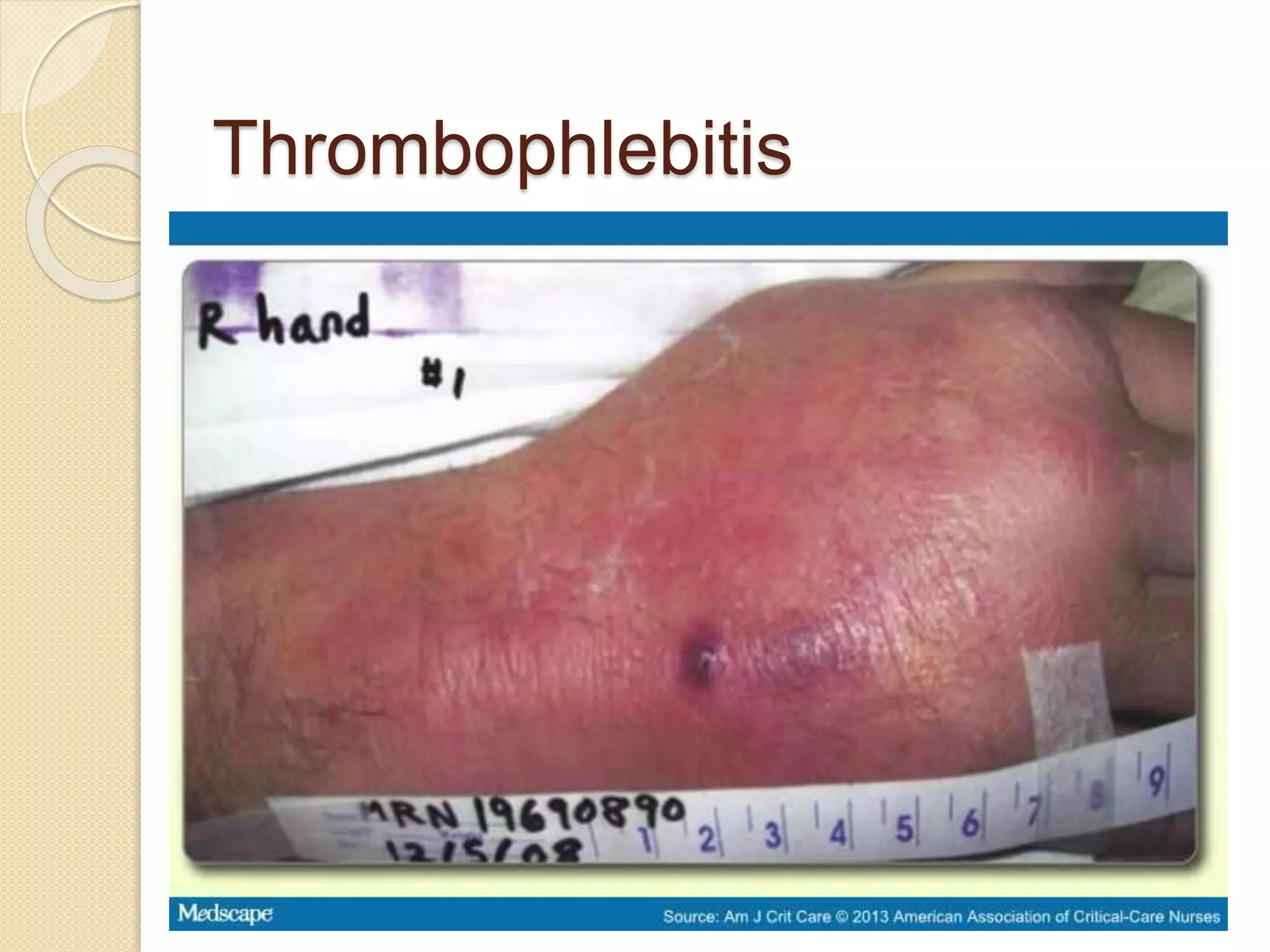 Intravenous Administration of Drugs | PPTX
