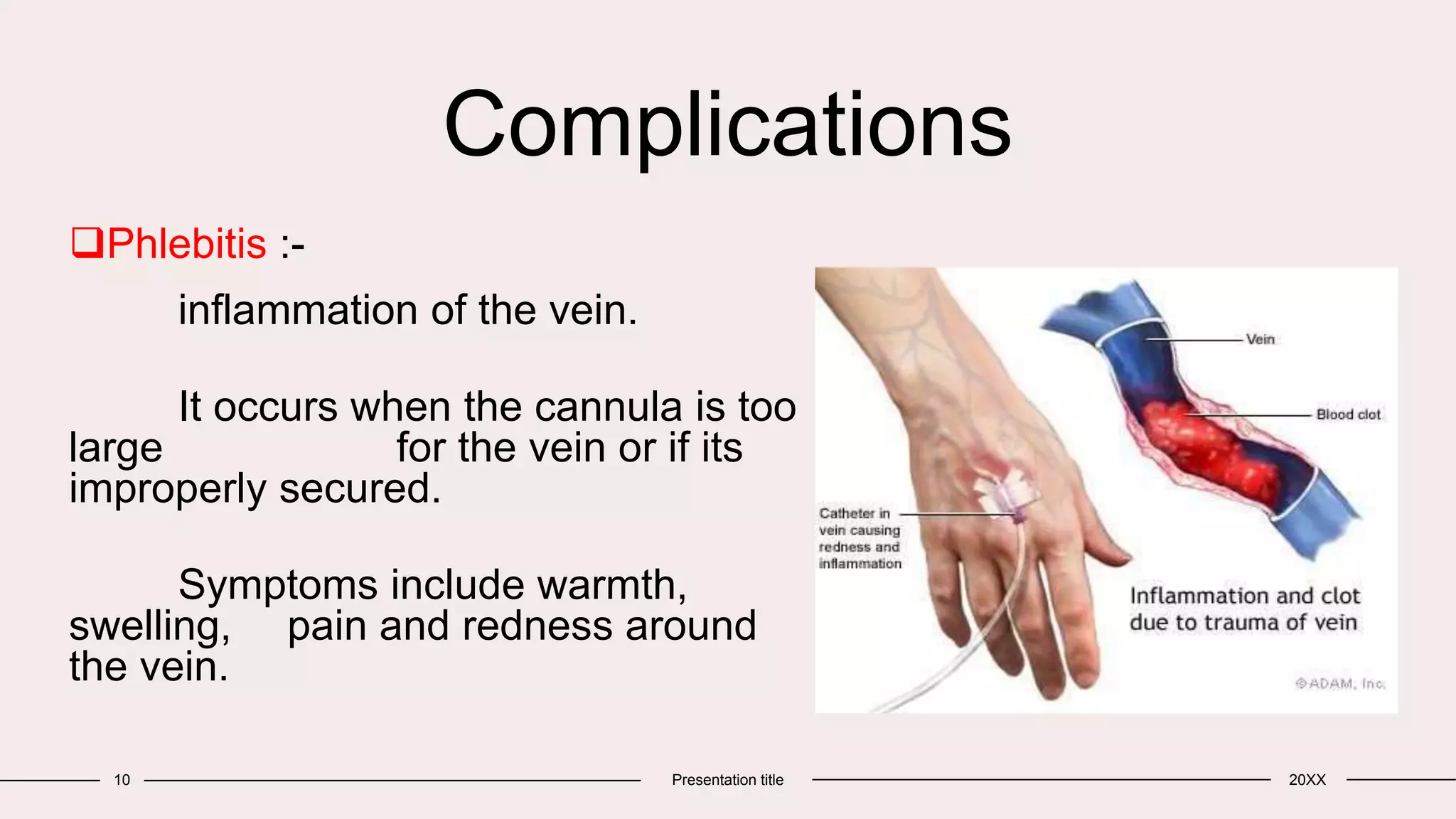 INTRAVENOUS INJECTION.pptx