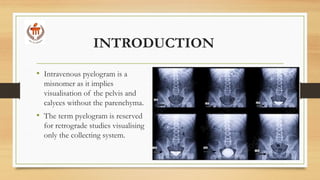 intravenous pylogram (IVP/IVU) intravenous urogram | PPTX