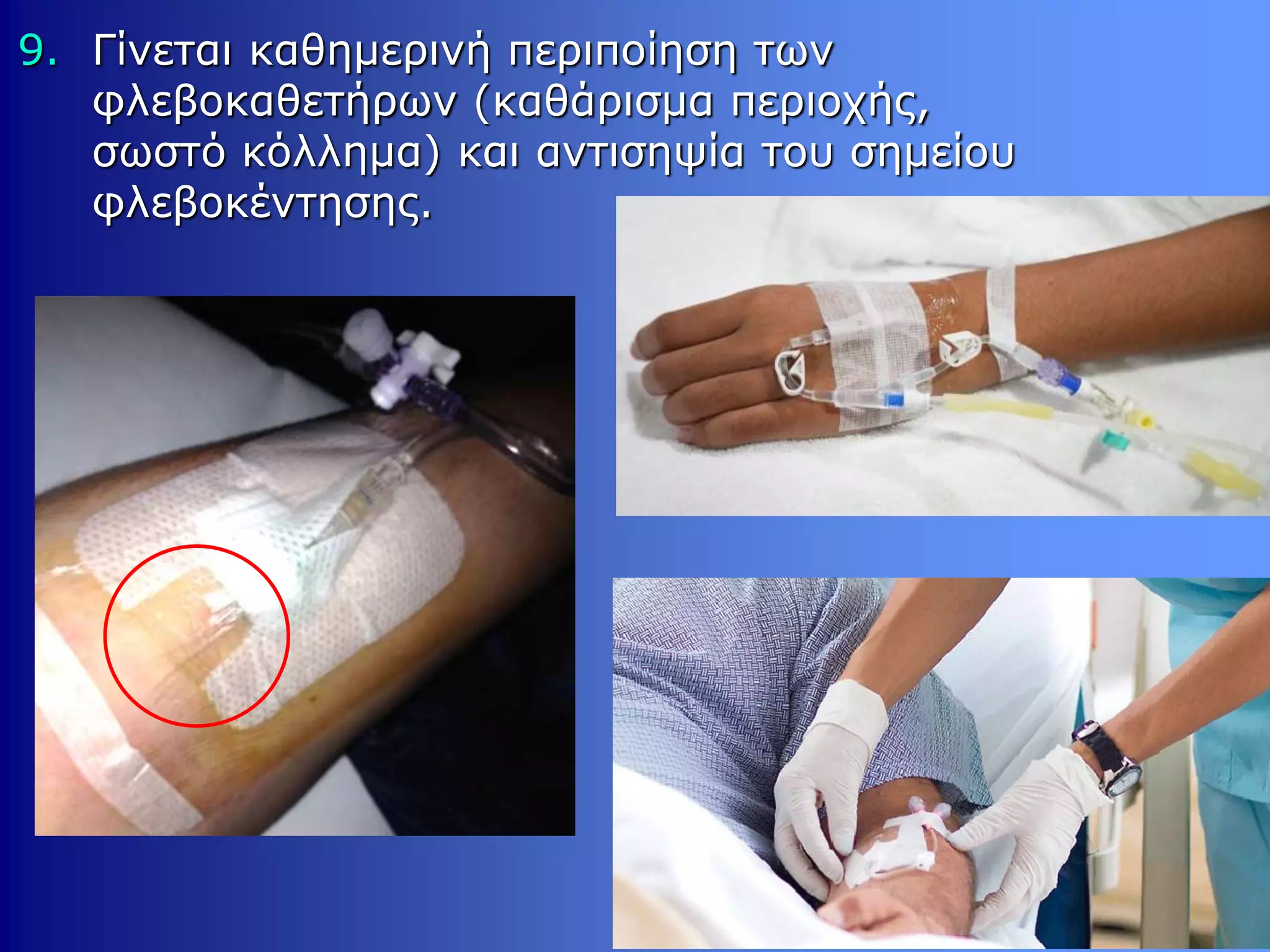 Ενδοφλέβια χορήγηση υγρών και φαρμάκων | PPTX