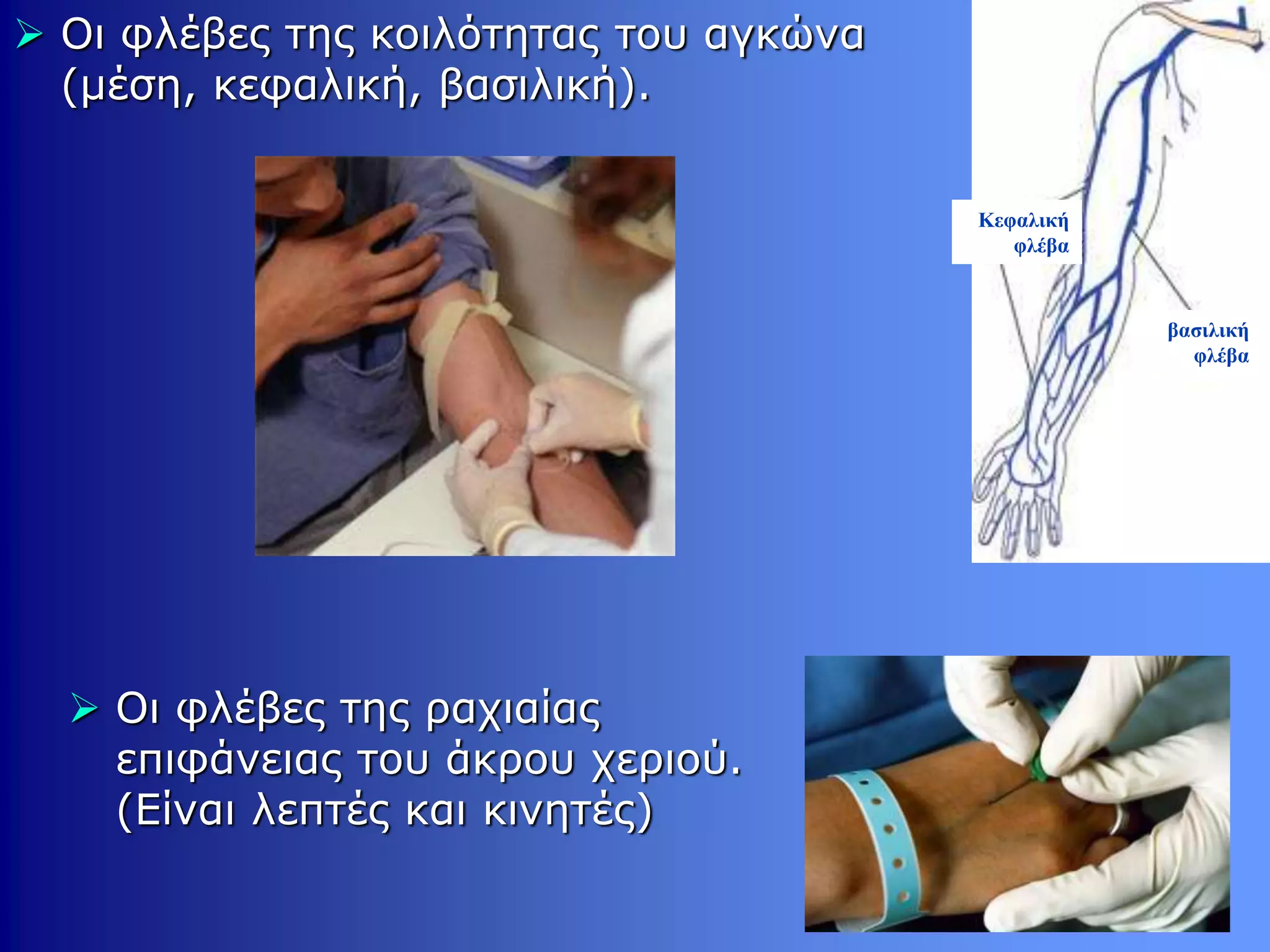 Ενδοφλέβια χορήγηση υγρών και φαρμάκων | PPTX