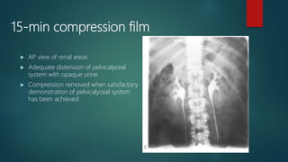 Intravenous urography | PPT