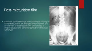 Intravenous urography | PPT