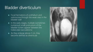 Intravenous urography | PPT
