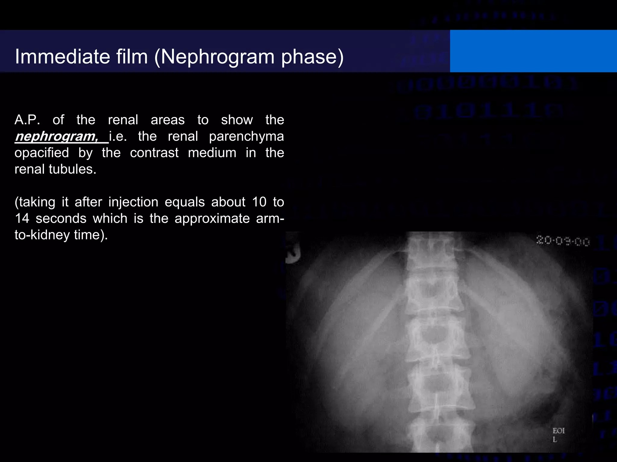Intravenous urography (IVU) | PDF