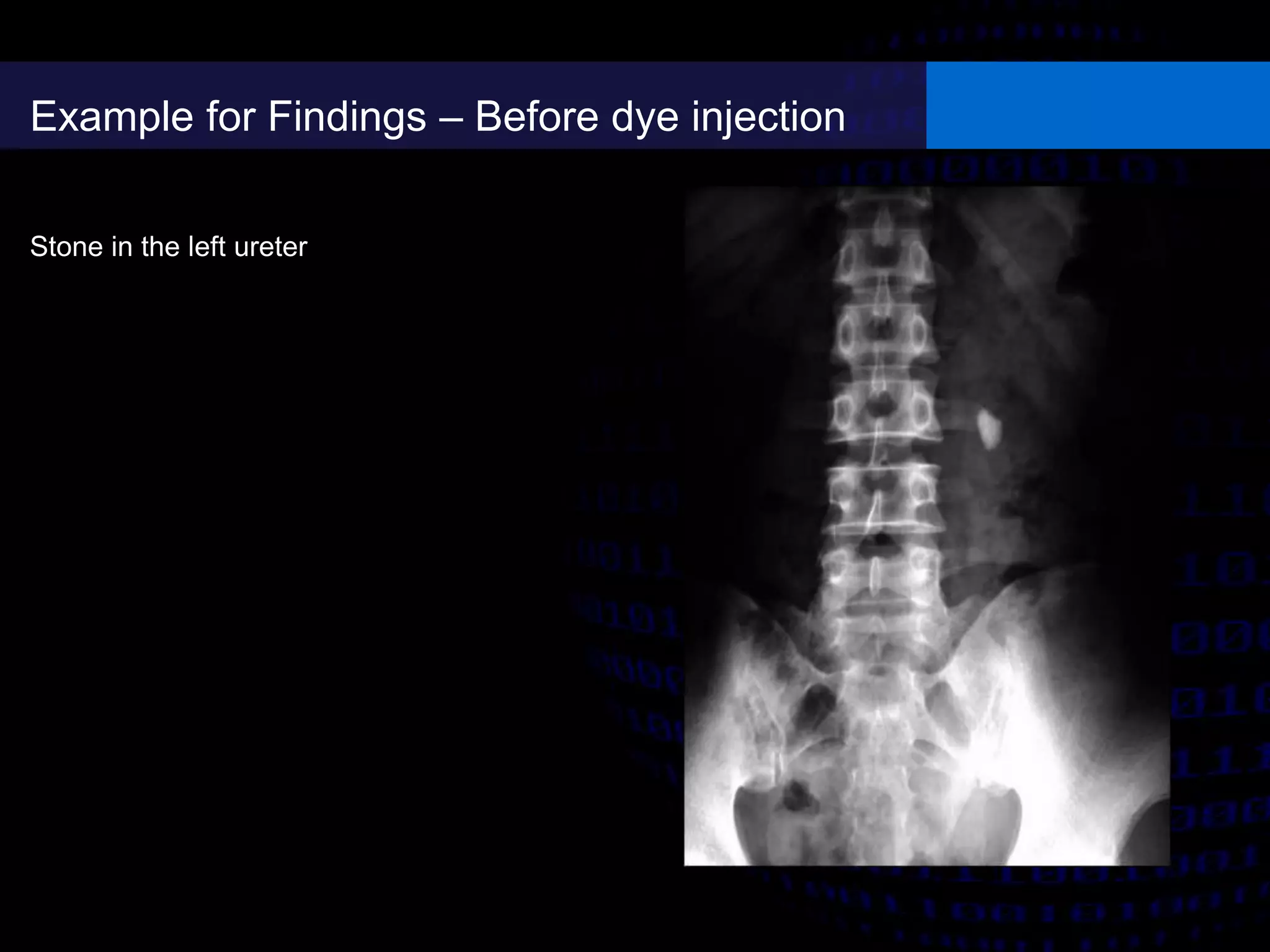 Intravenous urography (IVU) | PDF