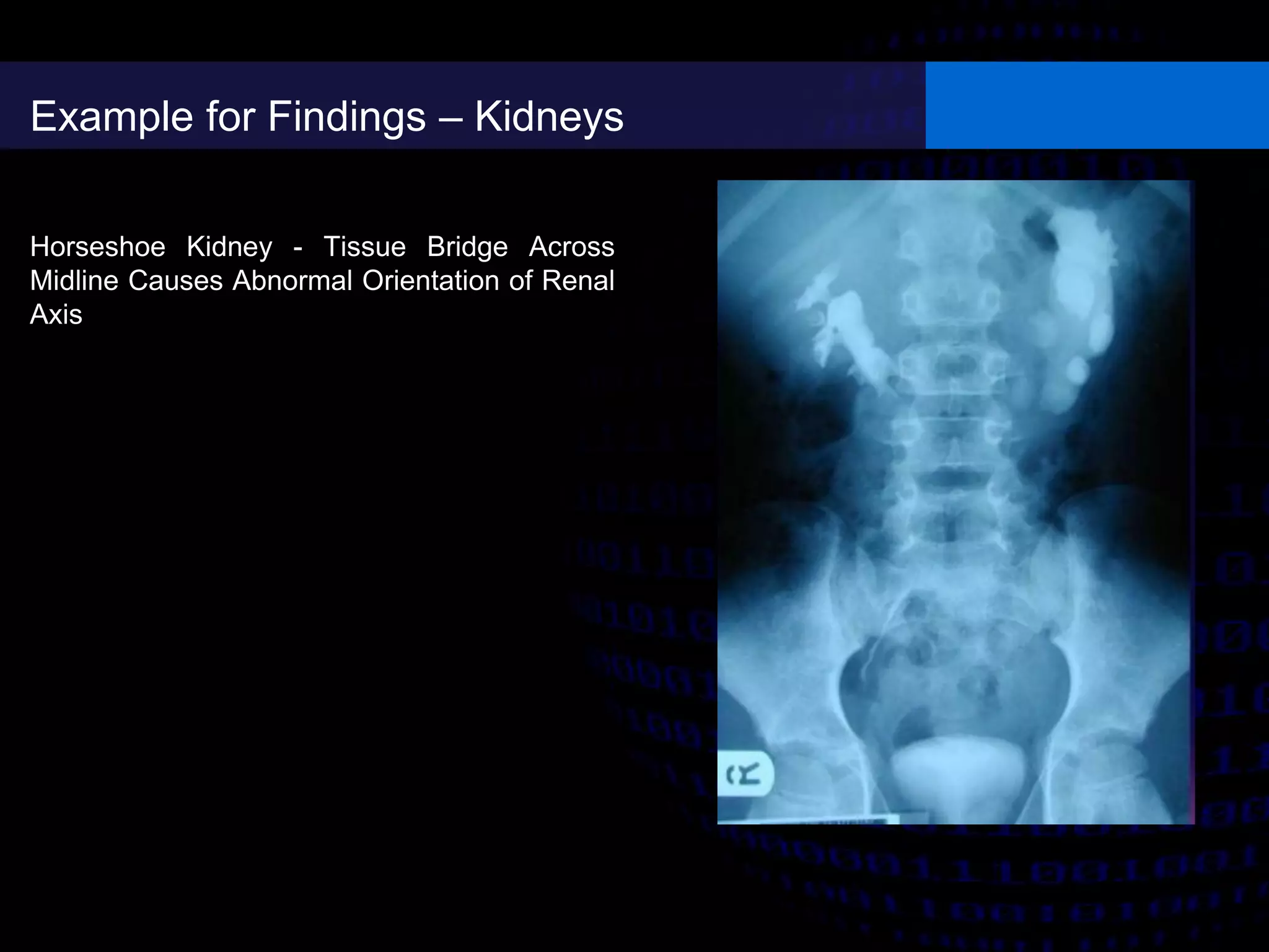 Intravenous urography (IVU) | PDF
