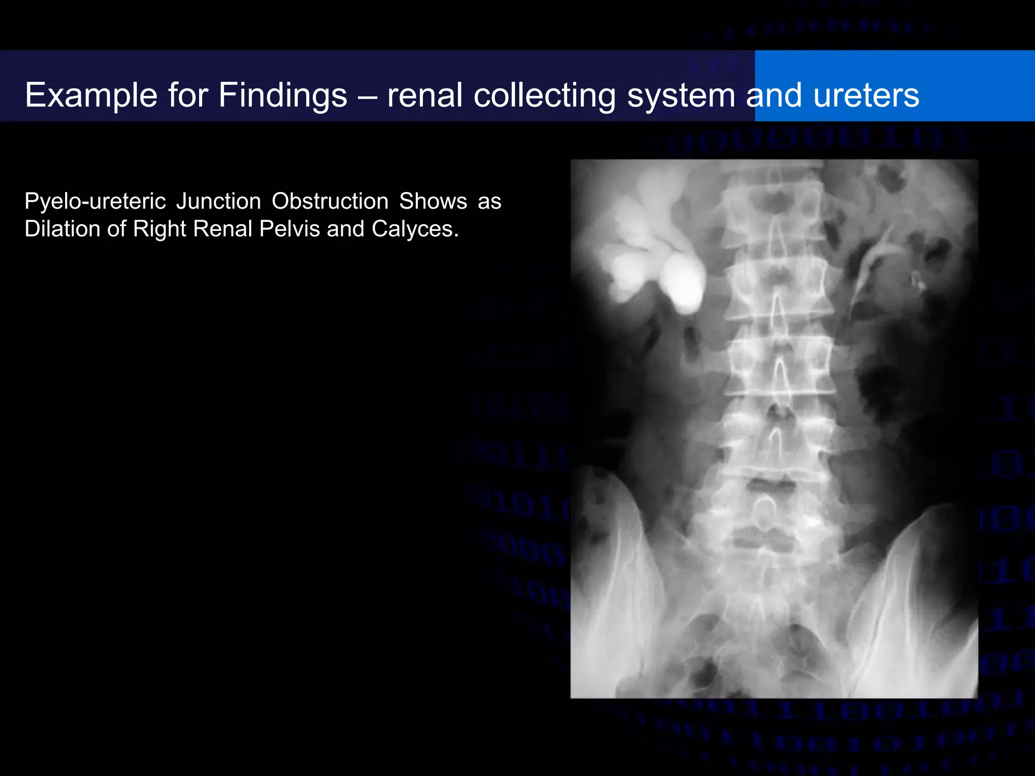 Intravenous urography (IVU) | PDF