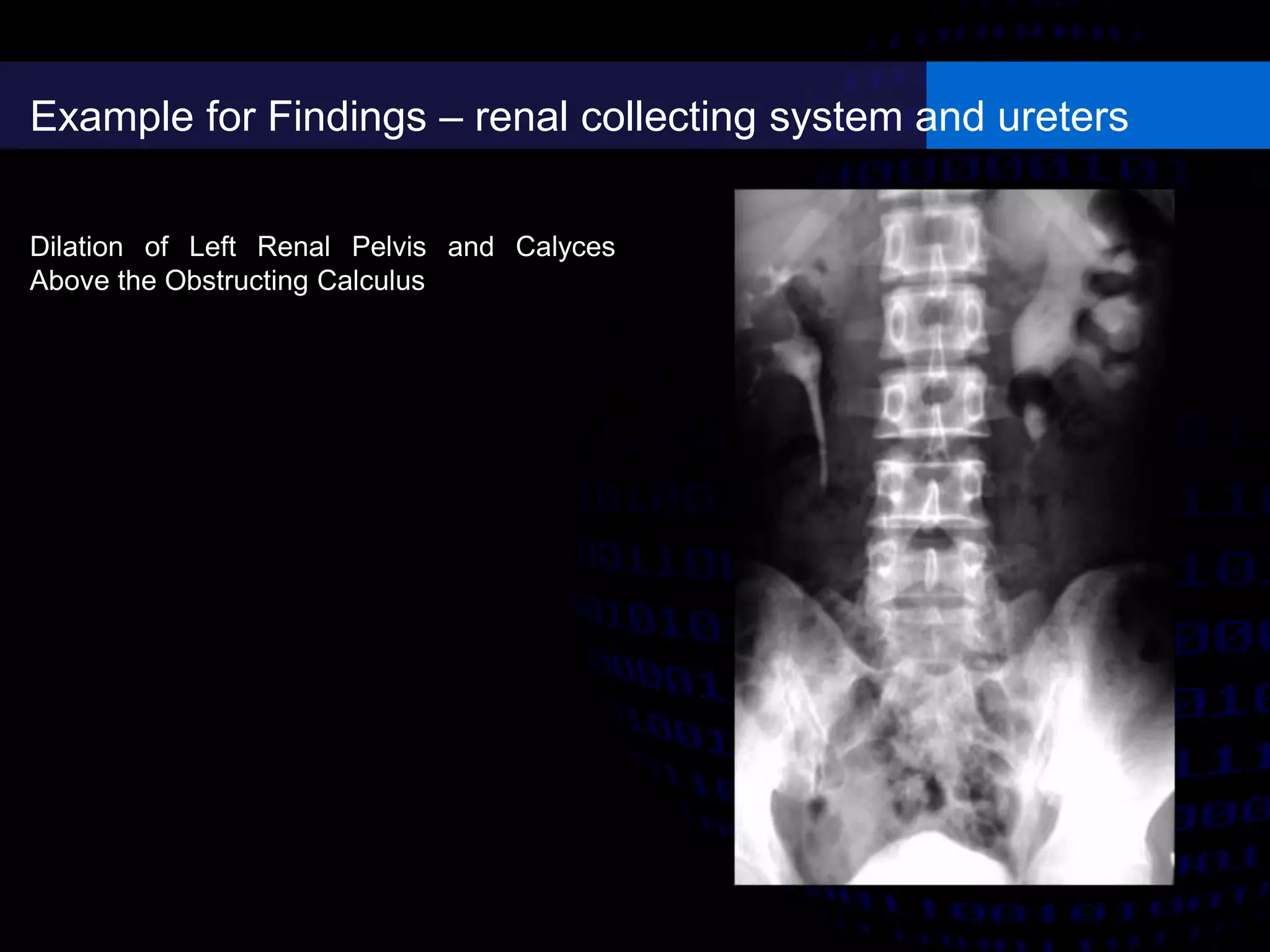 Intravenous urography (IVU) | PDF