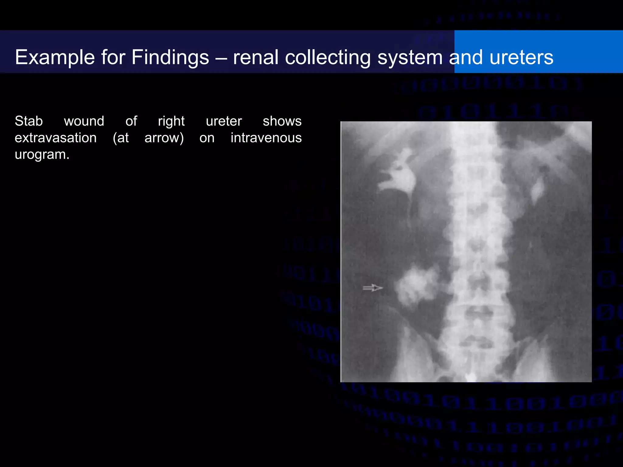 Intravenous urography (IVU) | PDF